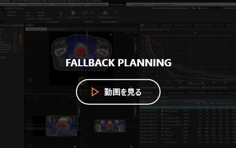 RayStationの機能｜自動化・効率化 : 日立ハイテク