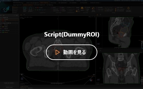 RayStationの機能｜自動化・効率化 : 日立ハイテク